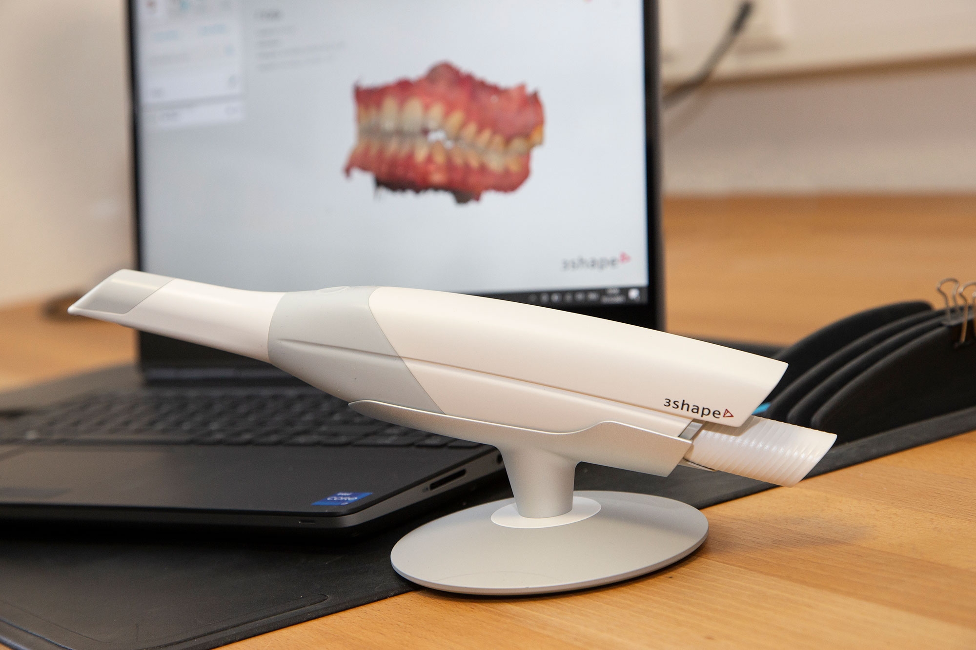 Intraoralscanner mieten - Fischer Zahntechnik